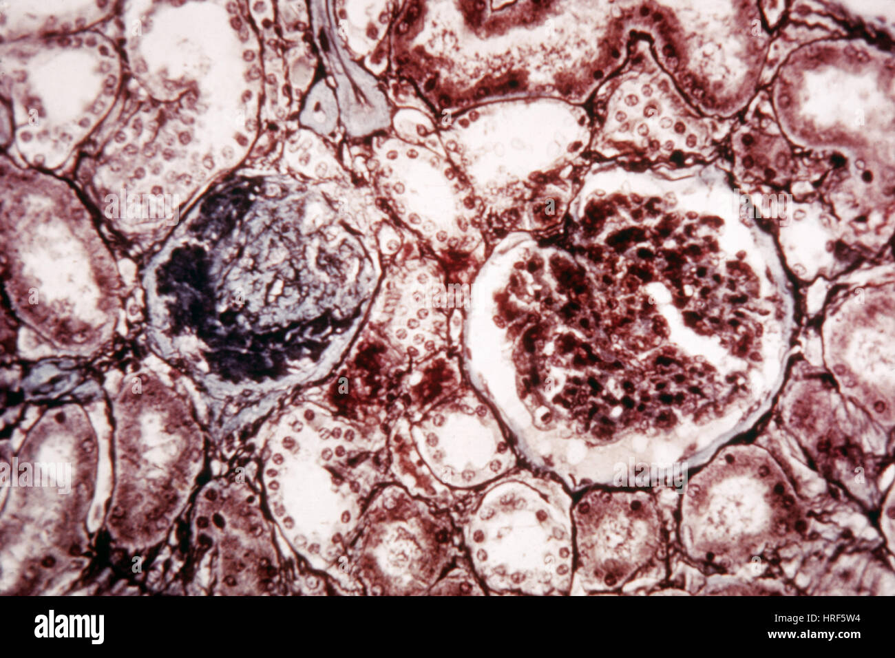 Endoplasmic reticulum micrograph hi-res stock photography and images ...