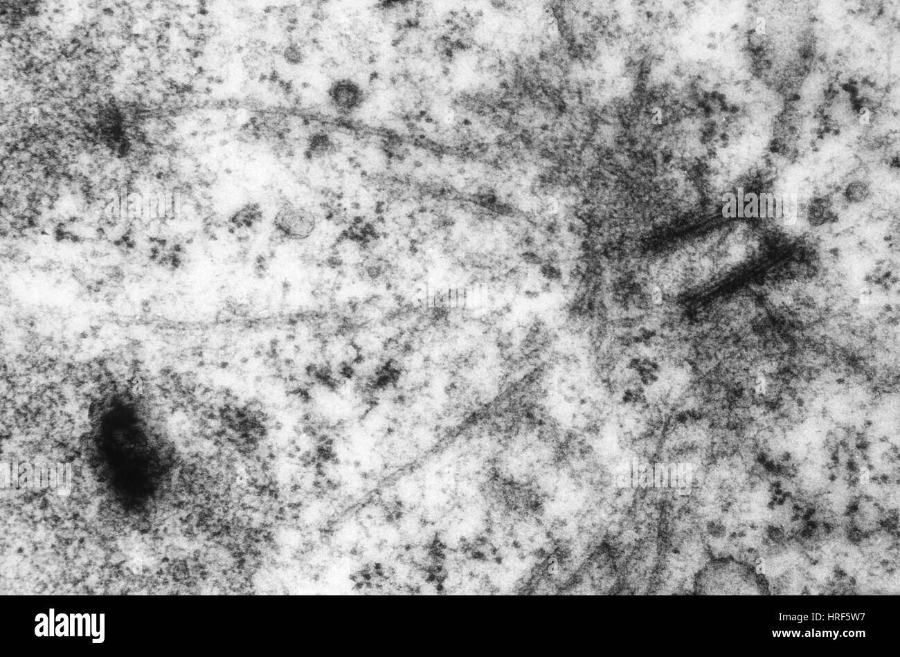 Centriole Micrograph