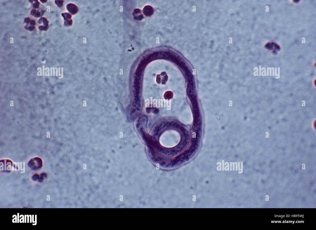 Wuchereria bancrofti hi-res stock photography and images - Alamy