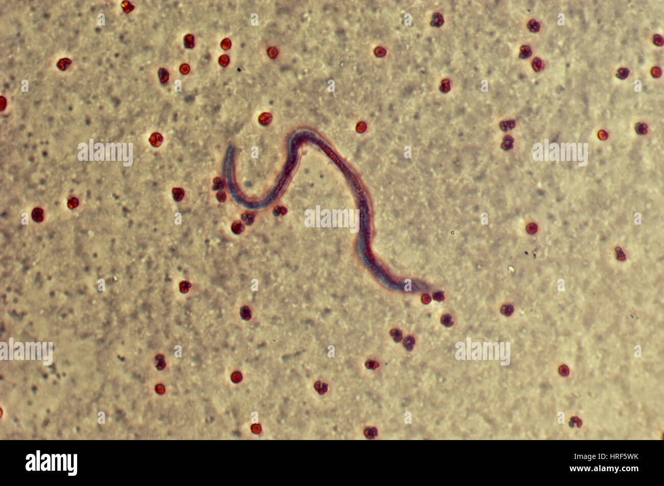 Ciclo Di Vita Della Wuchereria Bancrofti