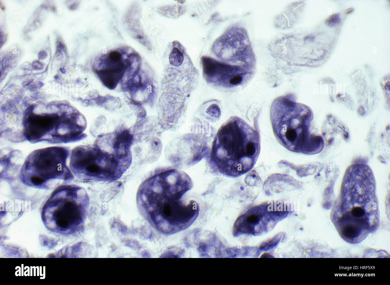 Parabasala hi-res stock photography and images - Alamy