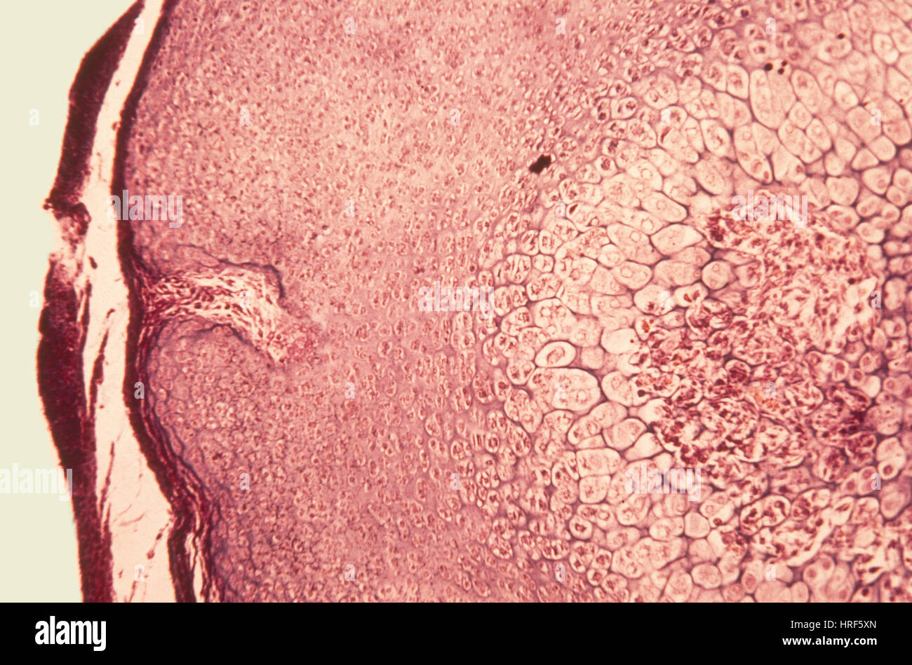 Fetal bone histology hi-res stock photography and images - Alamy