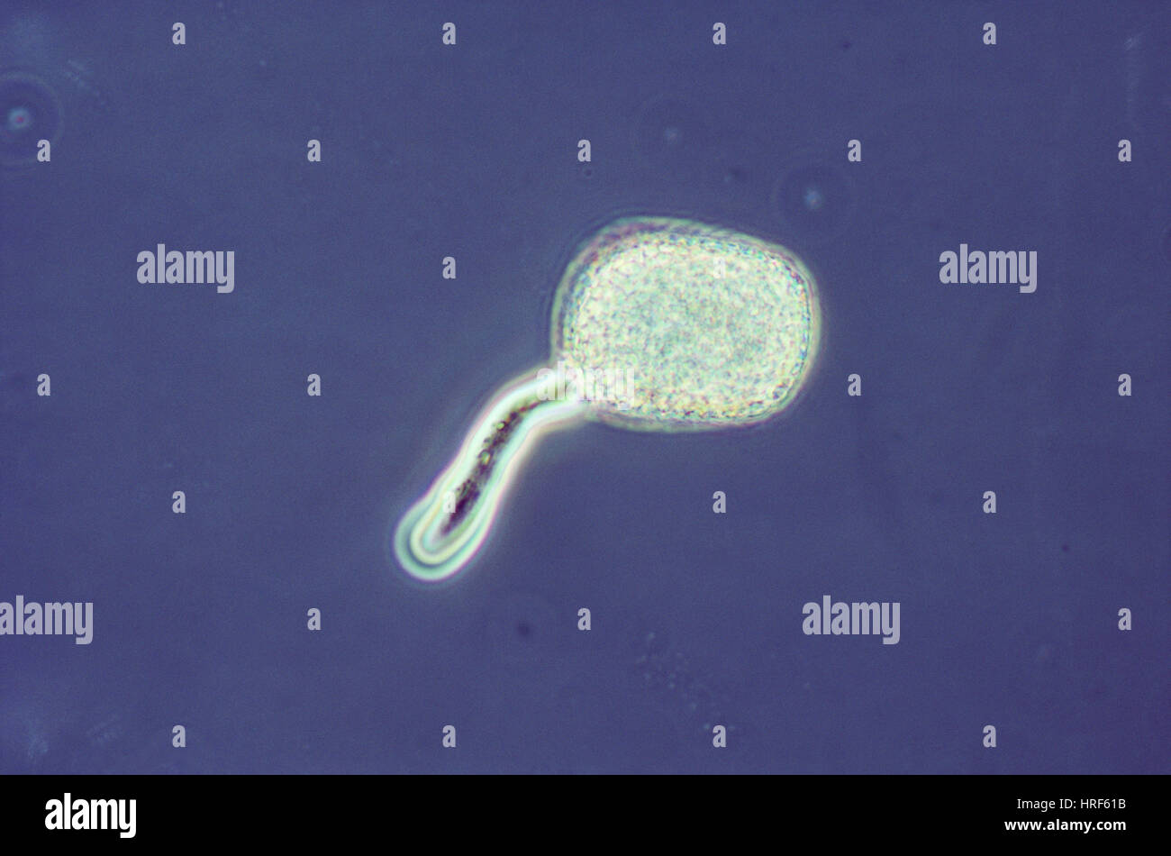 Impatiens Pollen (LM) (3 of 4 Stock Photo - Alamy