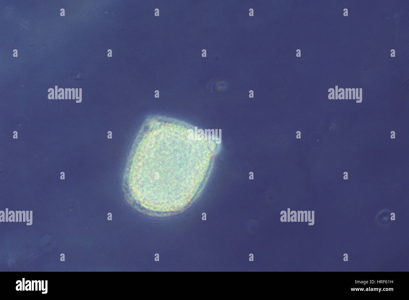 Impatiens Pollen (LM) (1 of 4 Stock Photo - Alamy