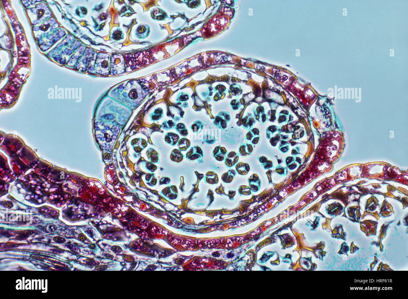 Fern Sori Microscope