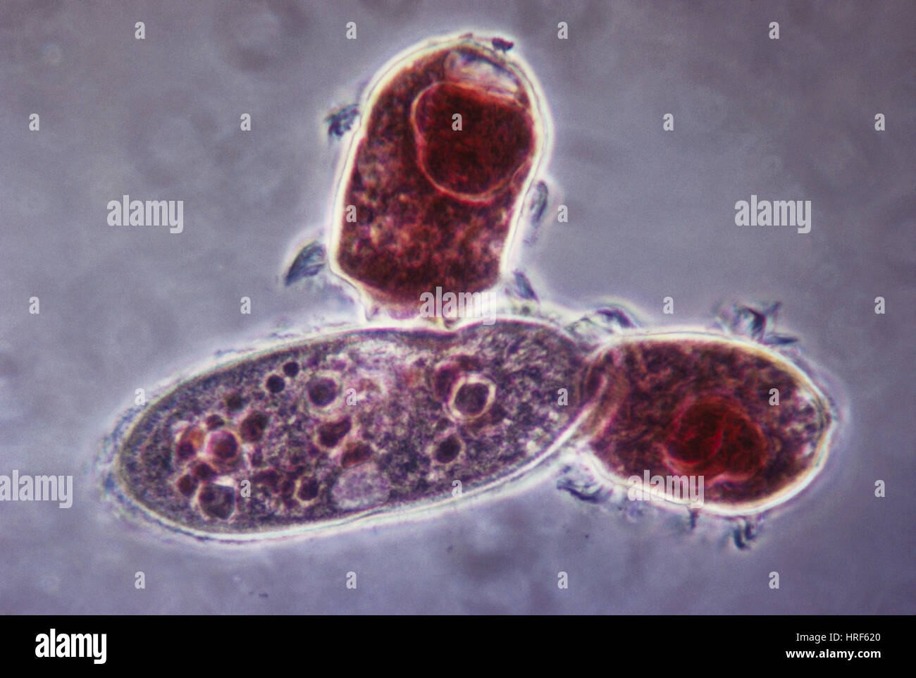 Didinium Under Microscope