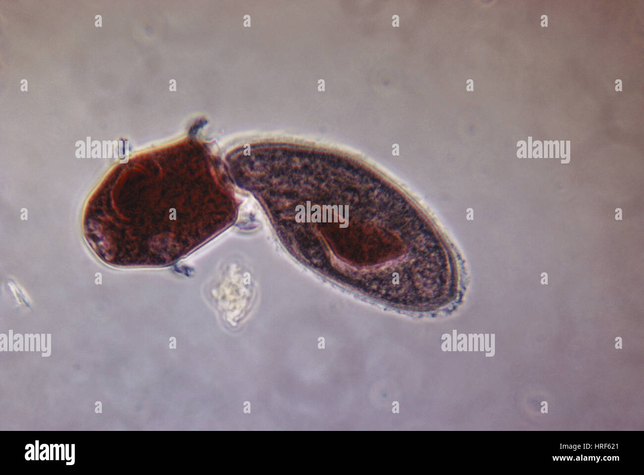 Didinium Under Microscope