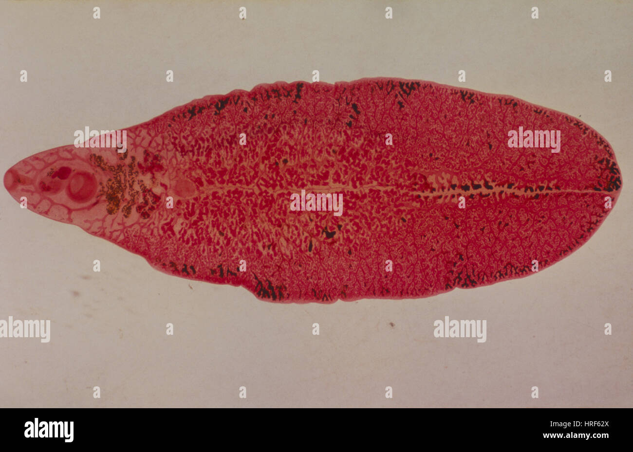 Human liver fluke hi-res stock photography and images - Alamy
