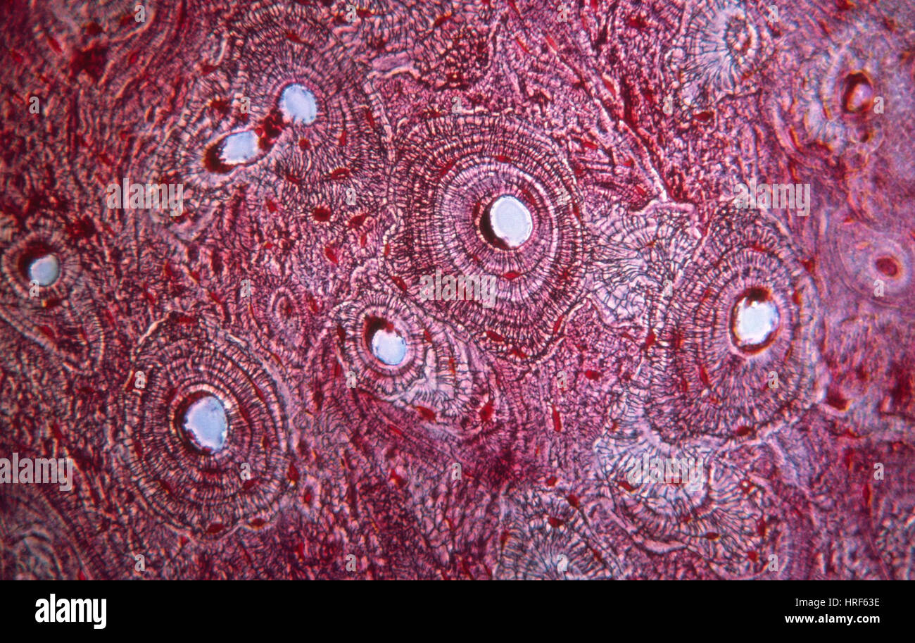 Osseous tissue hi-res stock photography and images - Alamy