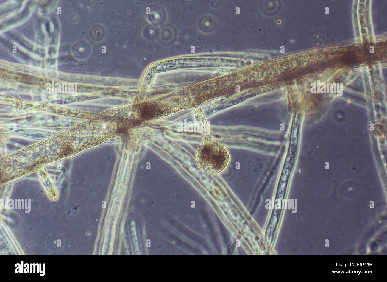 Oomycota Water Molds