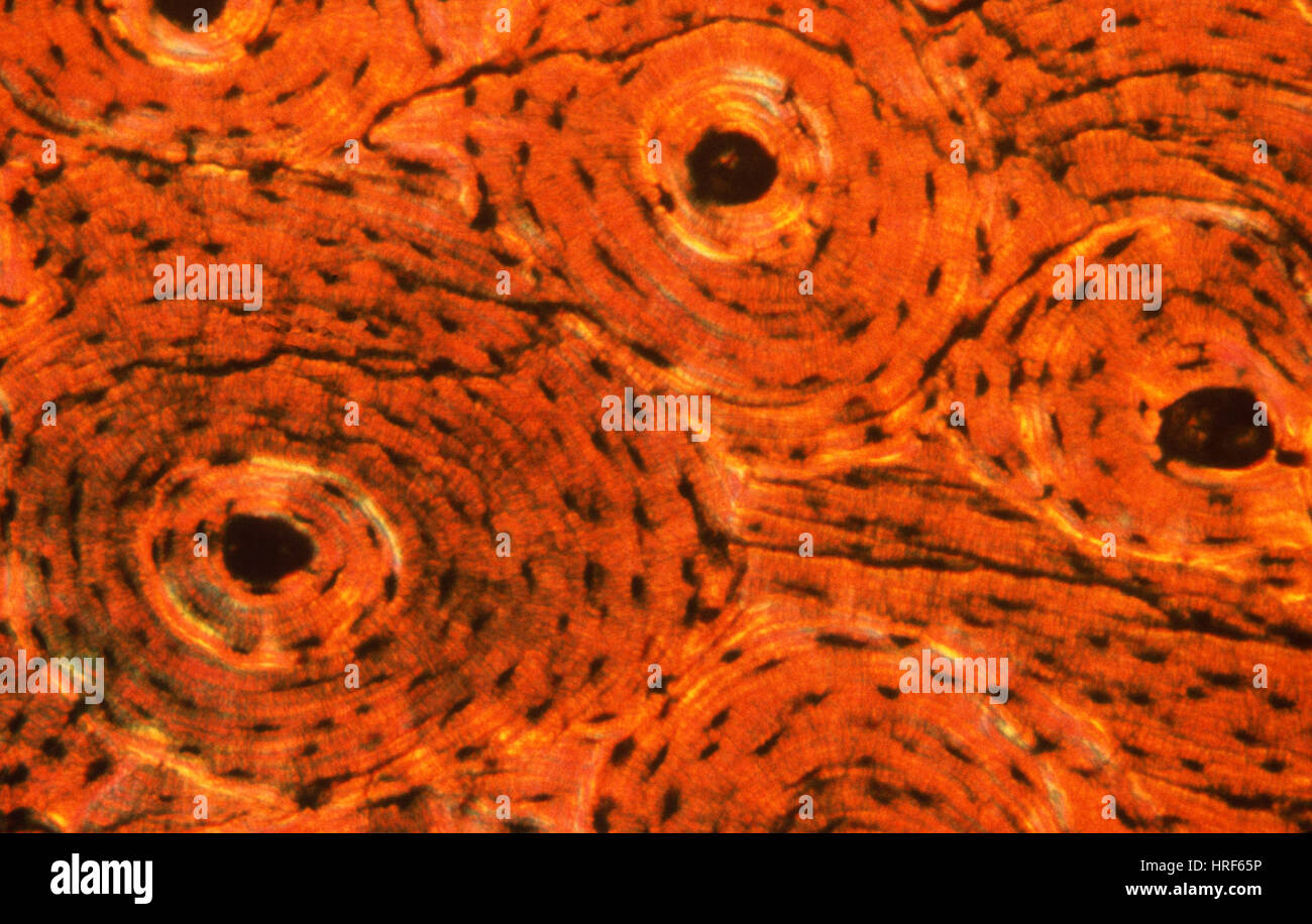 Osseous tissue hi-res stock photography and images - Alamy
