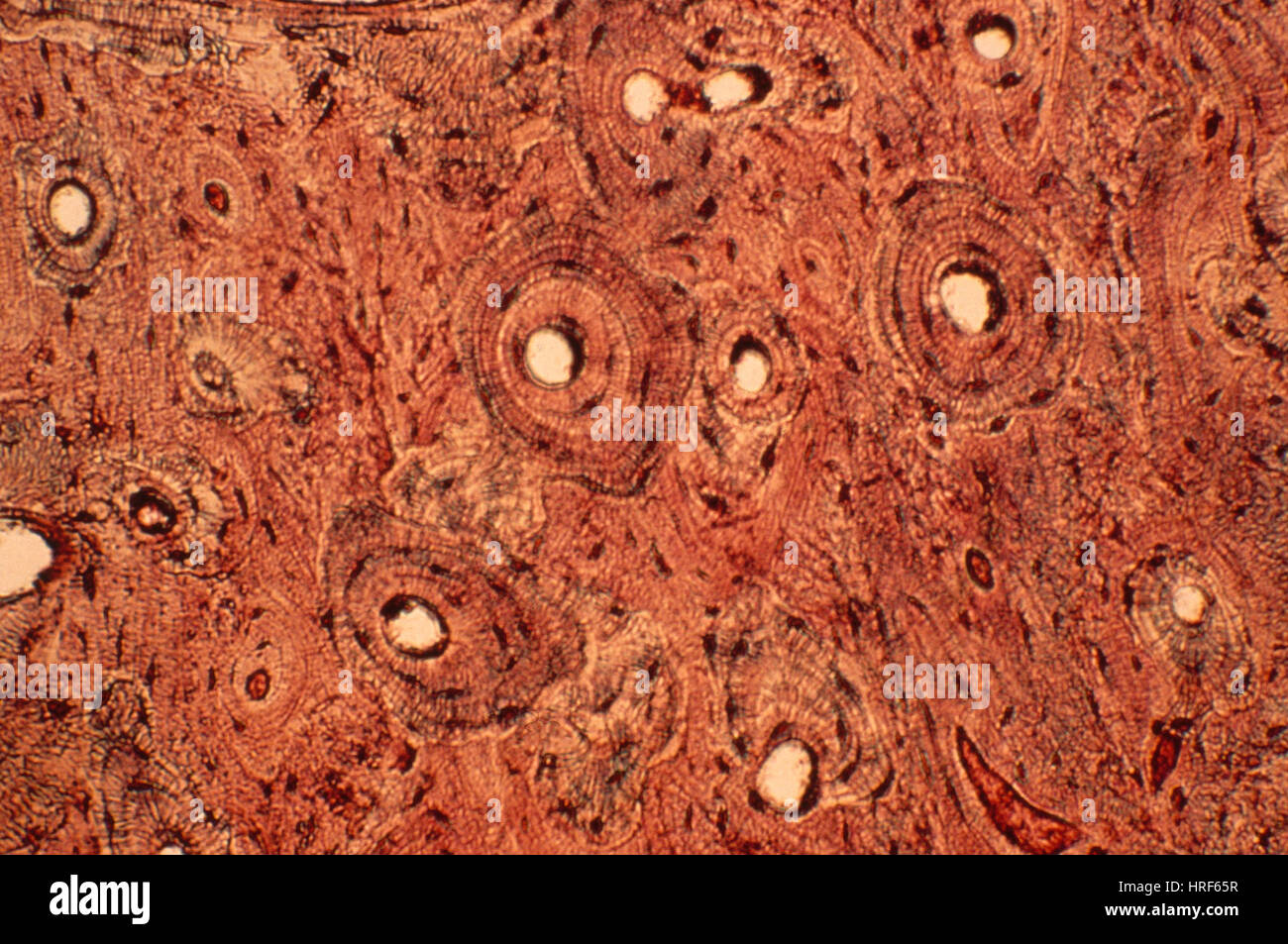 Bone tissue micrograph hi-res stock photography and images - Alamy
