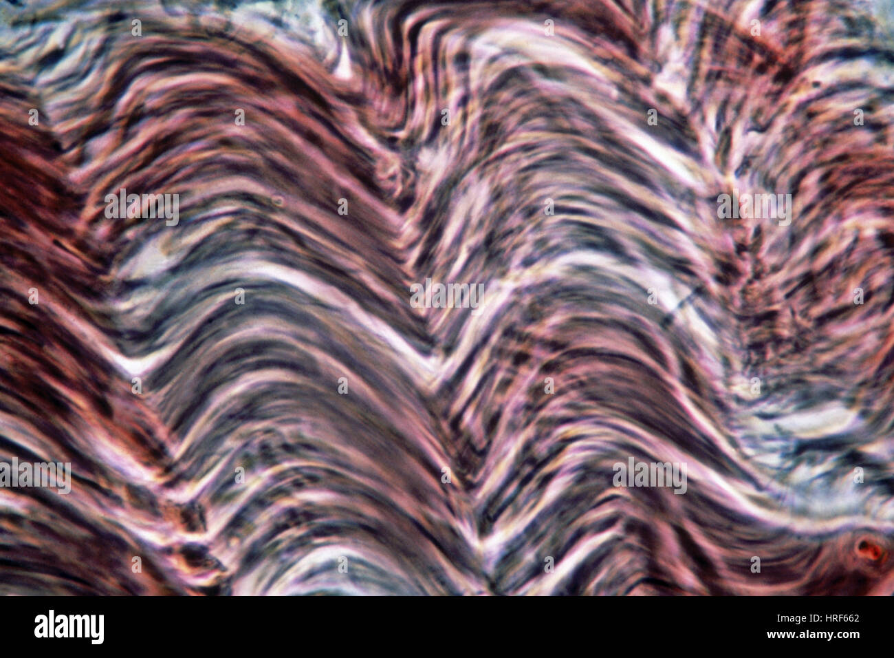 Smooth muscle cell hi-res stock photography and images - Alamy