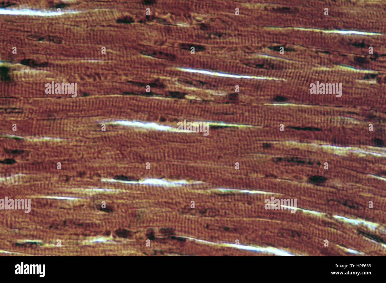 Cardiac Muscle Under Microscope Labeled