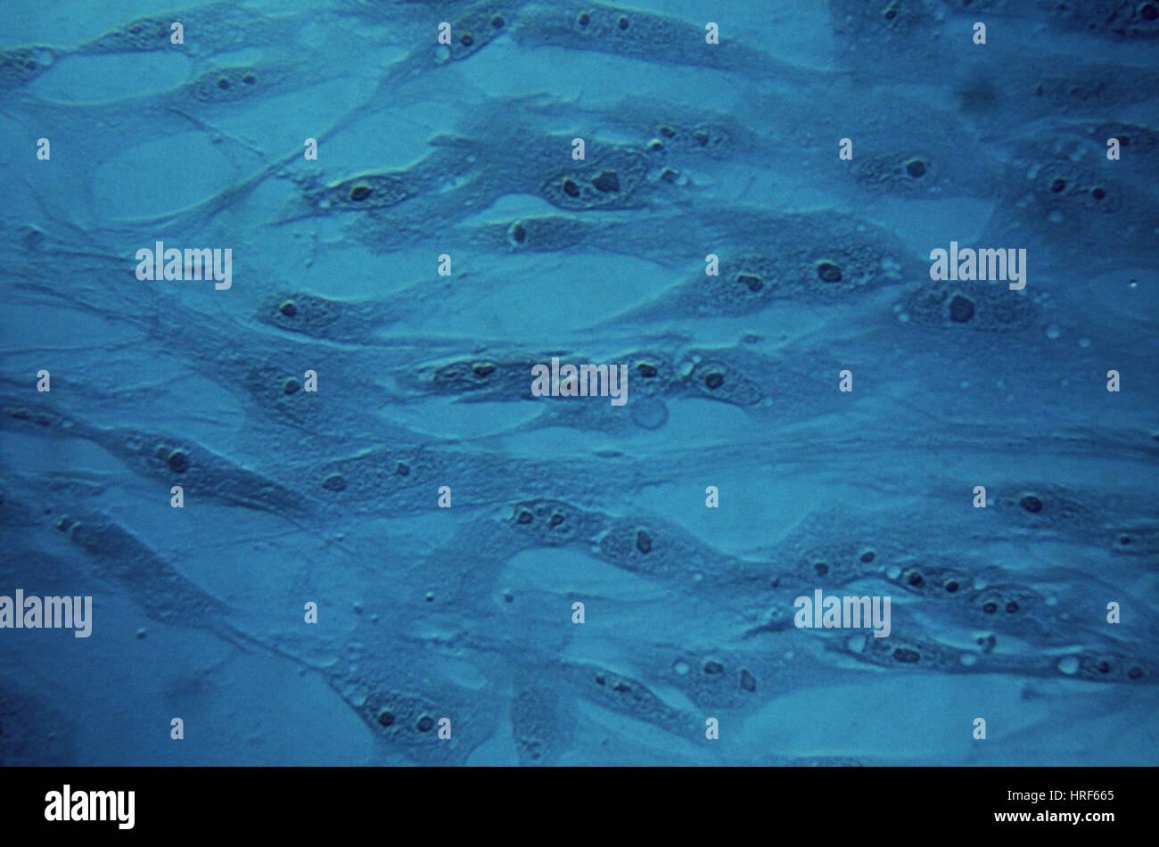 Fibroblast microscopy hi-res stock photography and images - Alamy