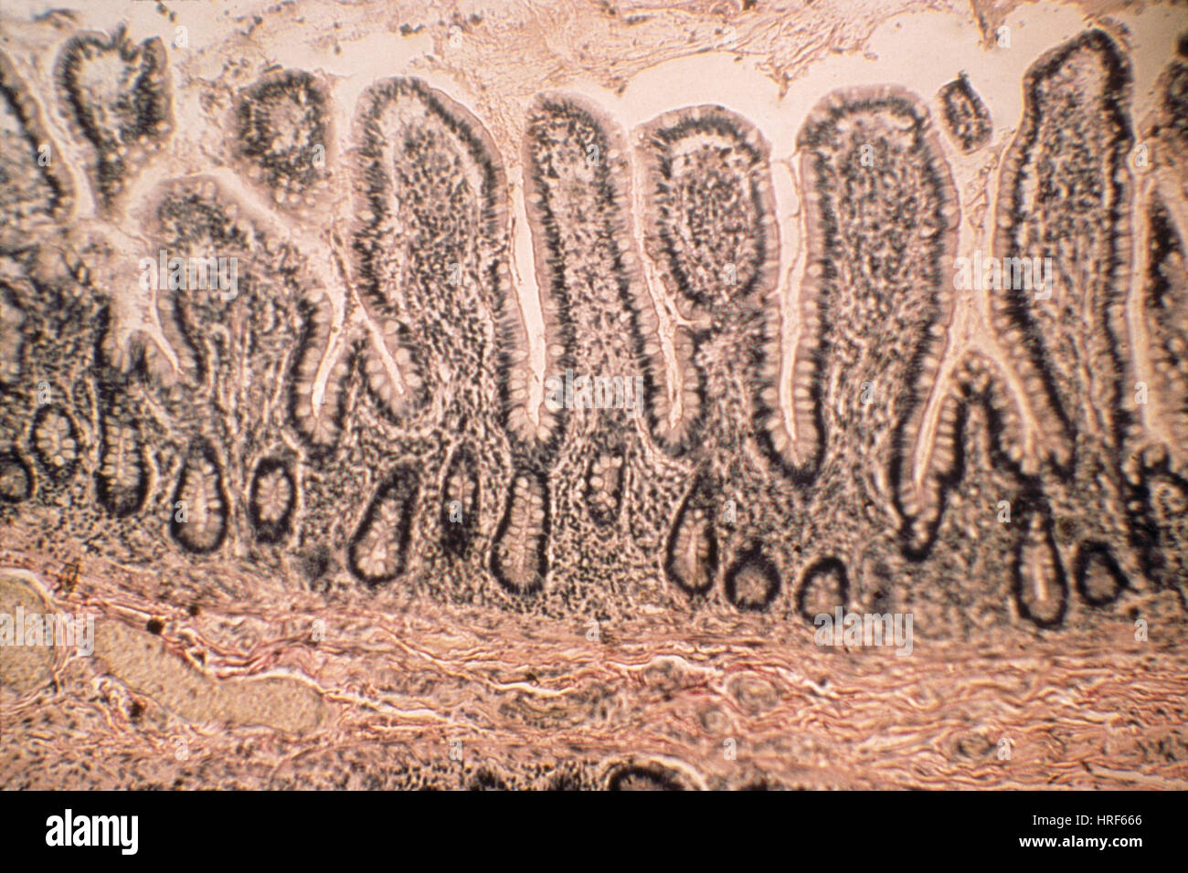 Vilii hi-res stock photography and images - Alamy