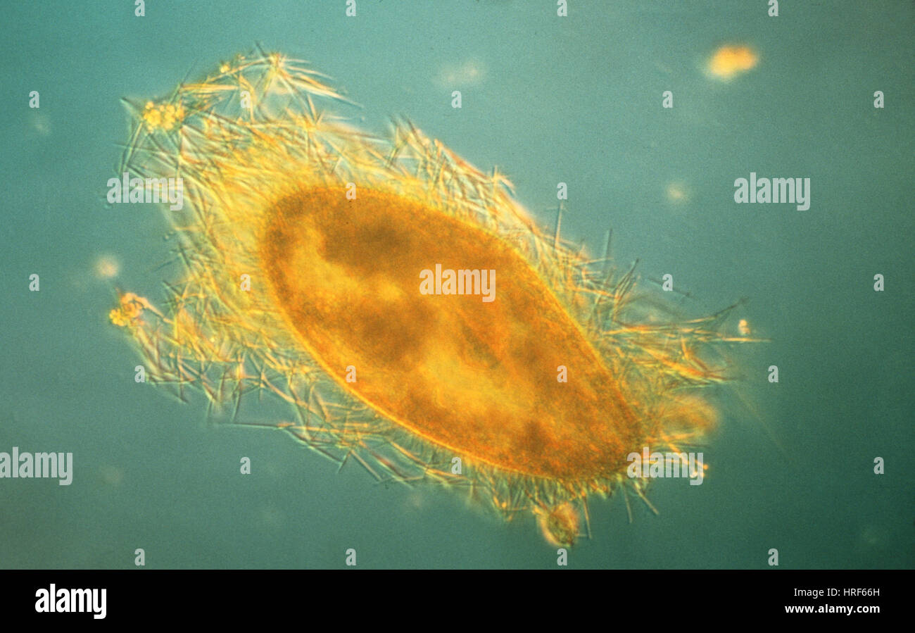 Paramecium with ejected trichocysts Stock Photo - Alamy
