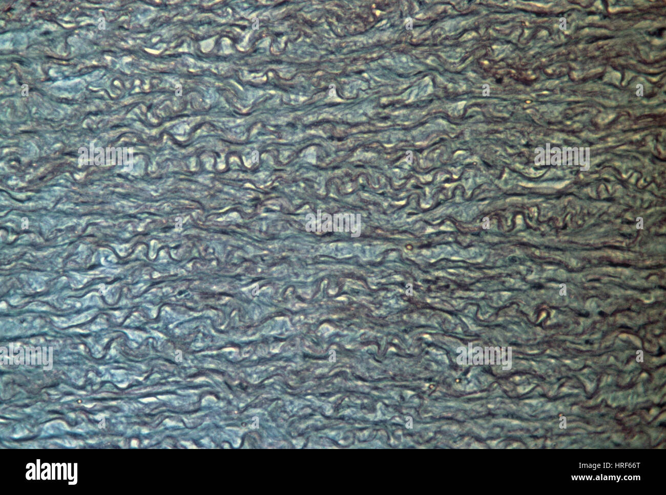 Human artery light micrograph hi-res stock photography and images - Alamy