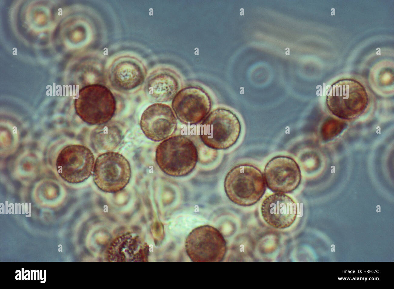 Plasmodial Slime Mold Under Microscope