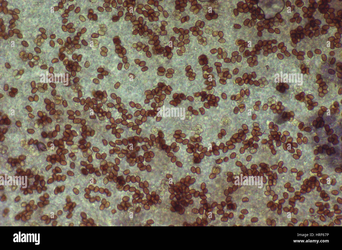 Mushroom spores micrograph hi-res stock photography and images - Alamy