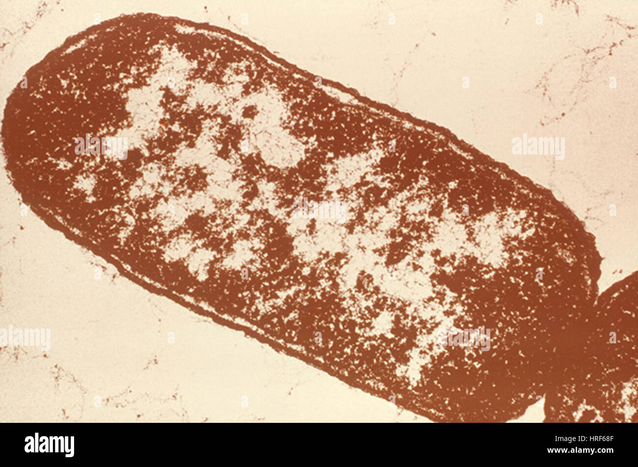 Micrograph of e. coli bacteria hi-res stock photography and images - Alamy