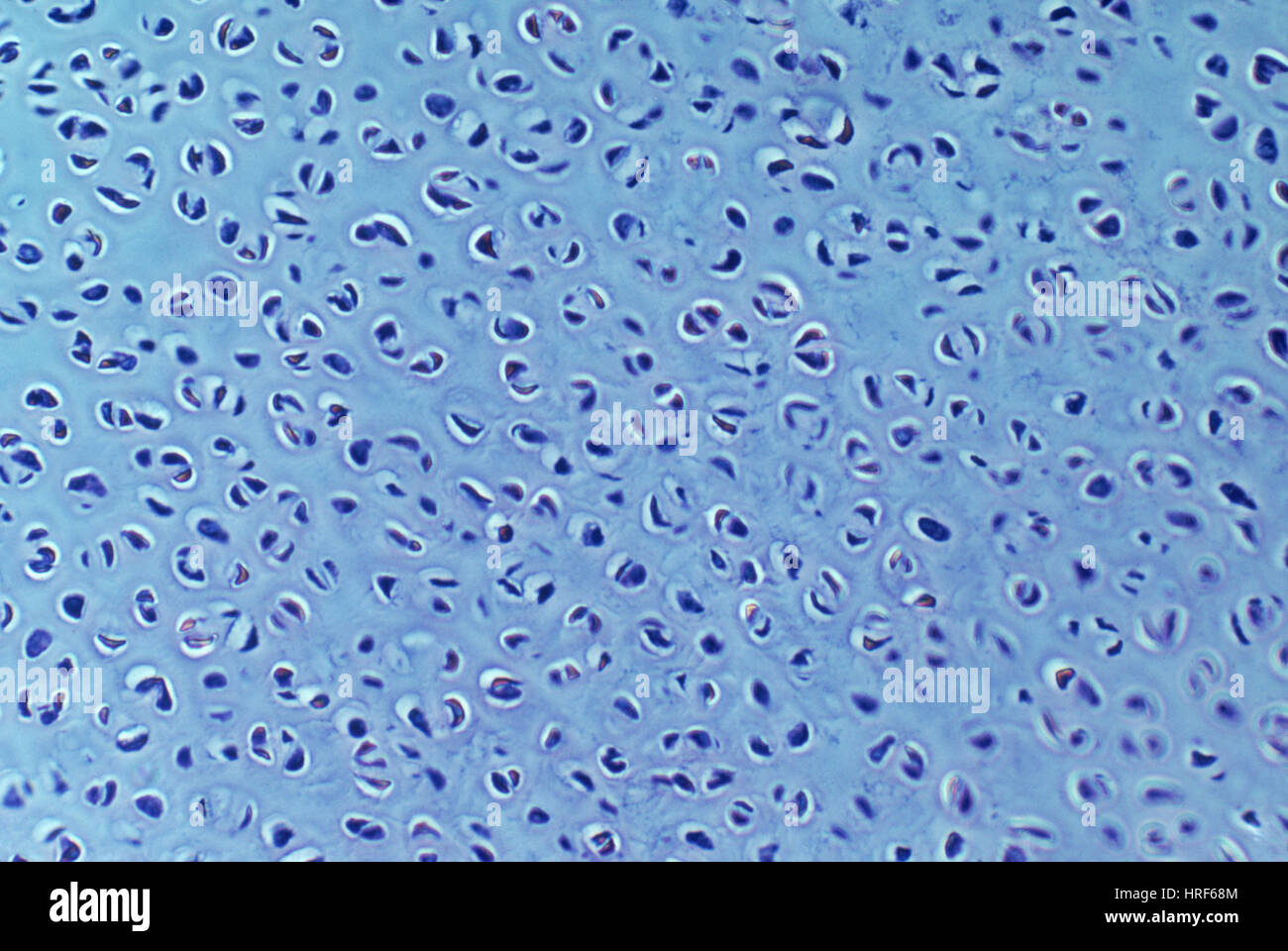 Hyaline Cartilage Perichondrium