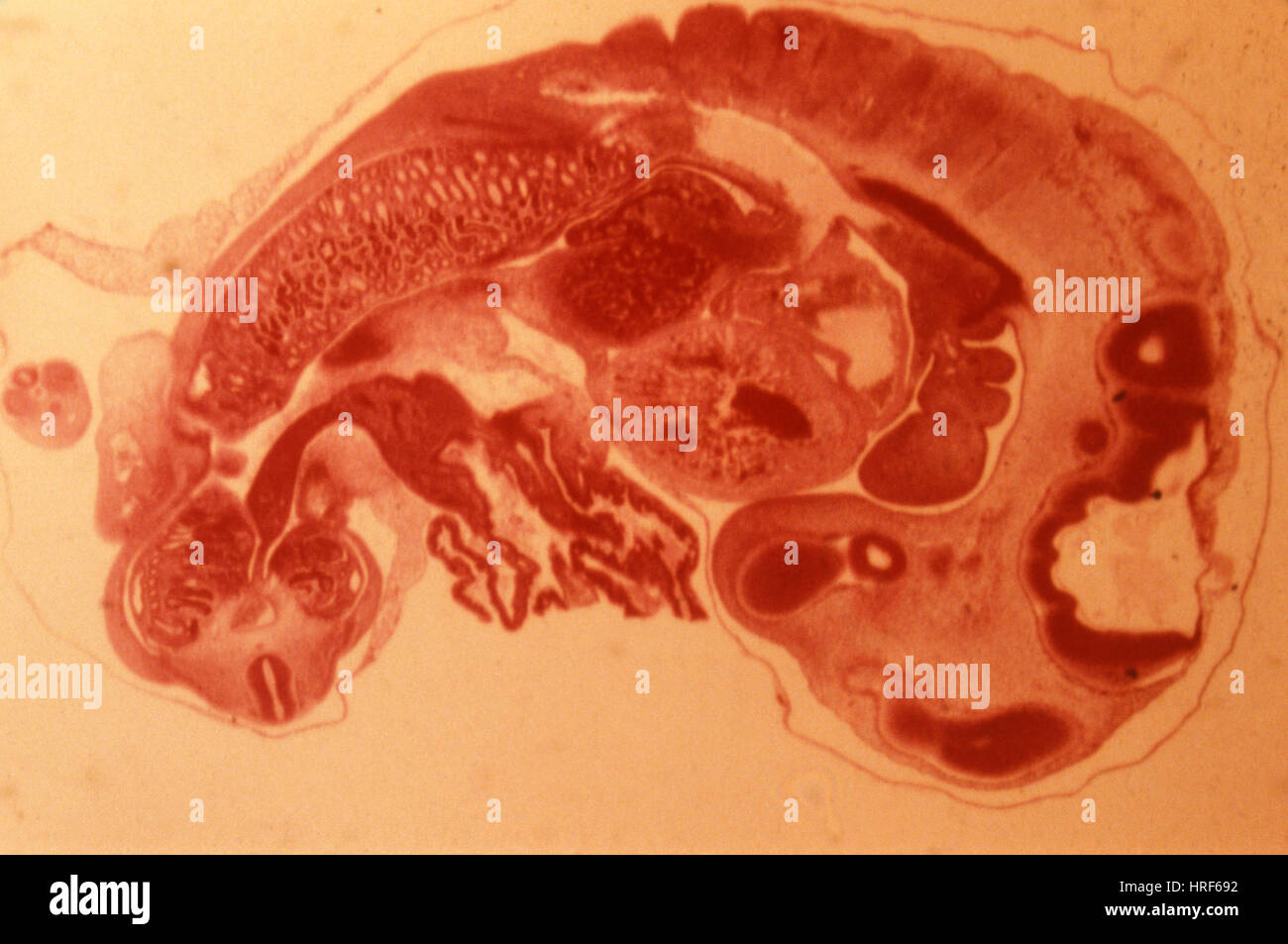 Pig fetus hi-res stock photography and images - Alamy