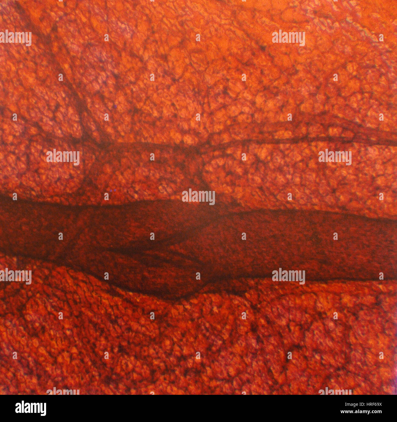Lymphatic valve hi-res stock photography and images - Alamy