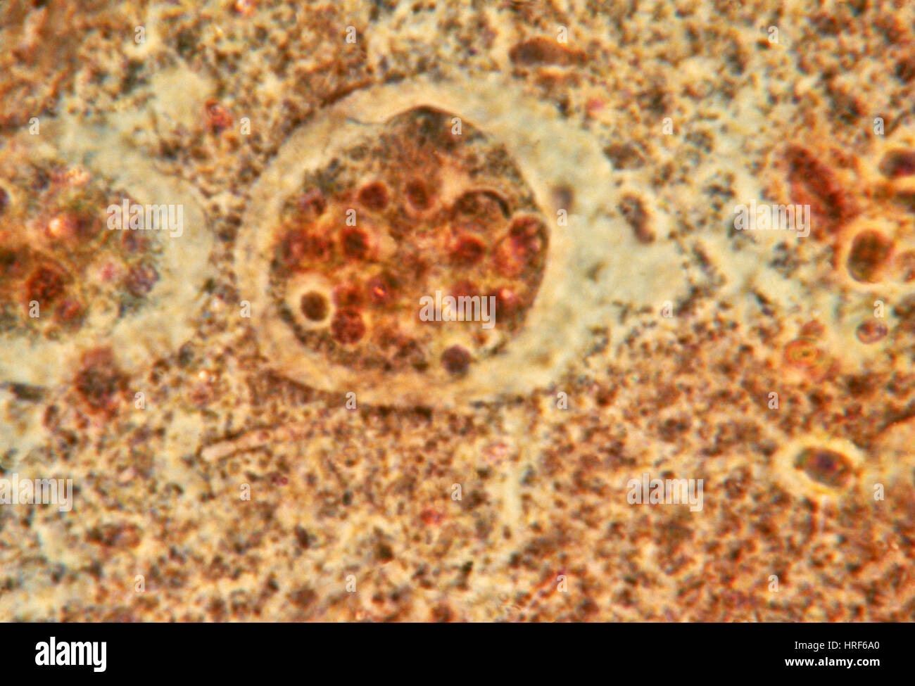 Entamoeba histolytica hi-res stock photography and images - Alamy