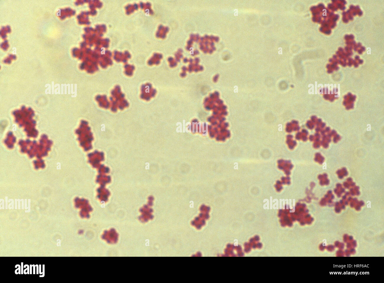 Sarcina flava hi-res stock photography and images - Alamy