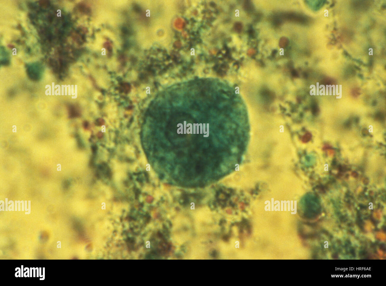 Entamoeba hi-res stock photography and images - Alamy