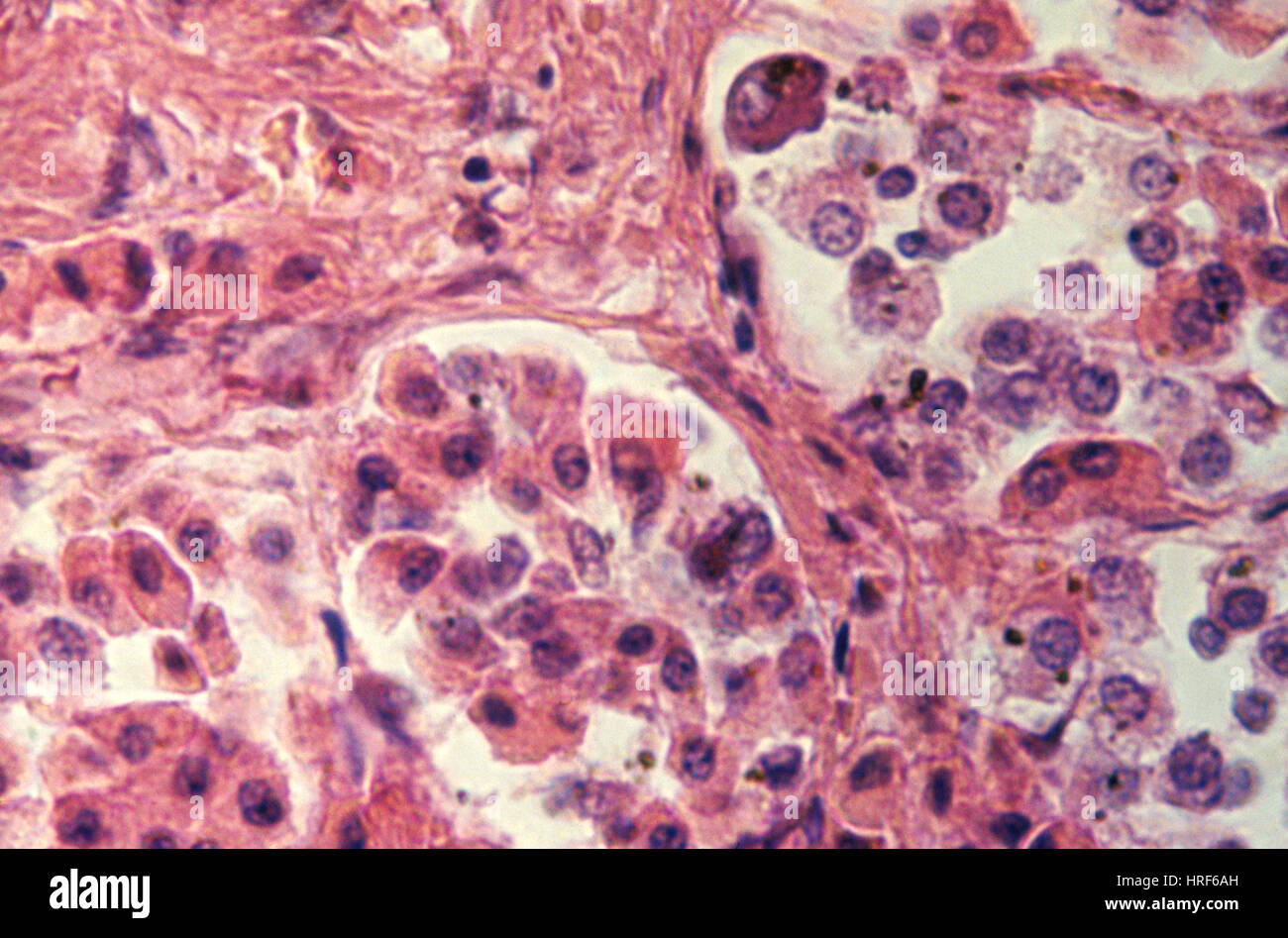 Glandular micrograph hi-res stock photography and images - Alamy