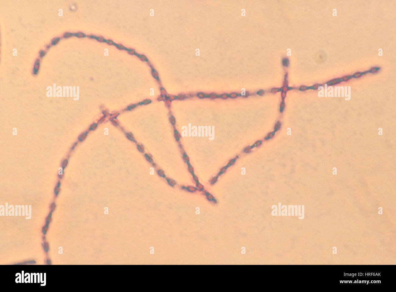 Bacillus Anthracis Micrograph High Resolution Stock Photography and ...