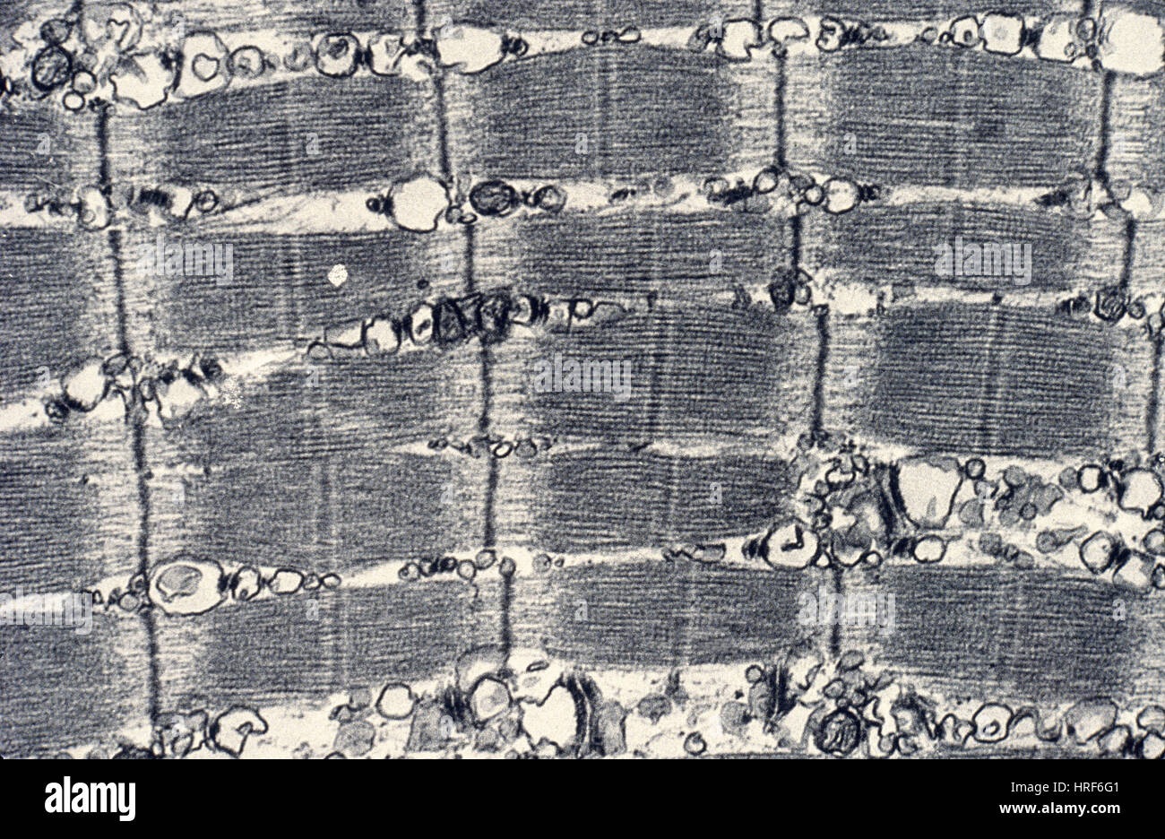 TEM of Skeletal Muscle Stock Photo - Alamy