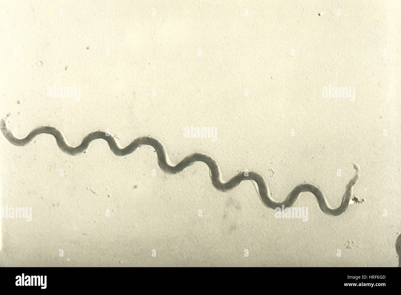 Treponema Pallidum Stock Photos & Treponema Pallidum Stock Images - Alamy