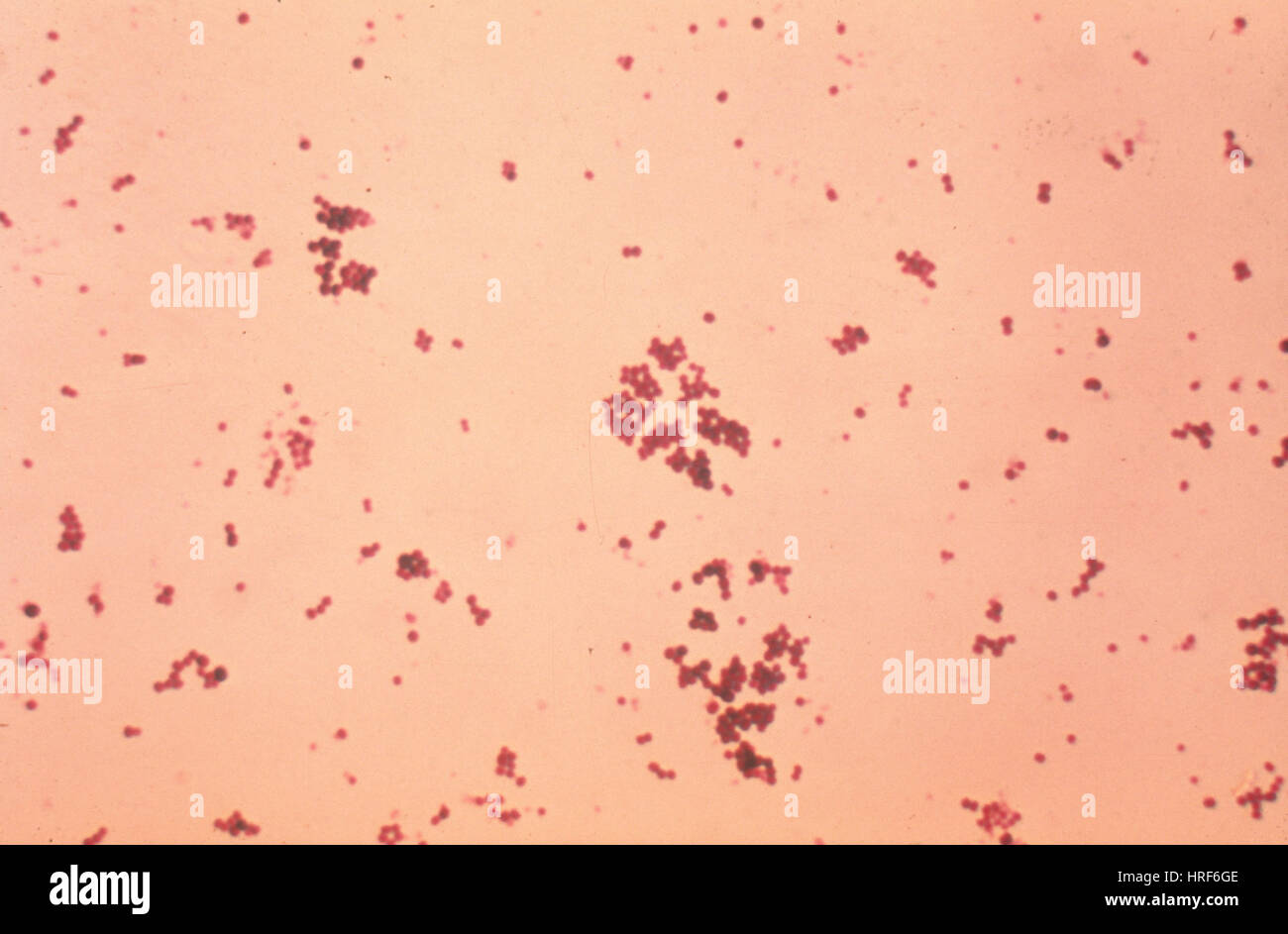 Staph aureus hi-res stock photography and images - Alamy