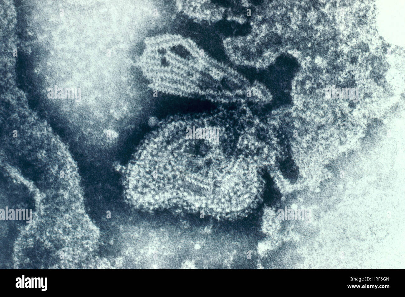 Paramyxovirus, Mumps Virus, TEM Stock Photo - Alamy