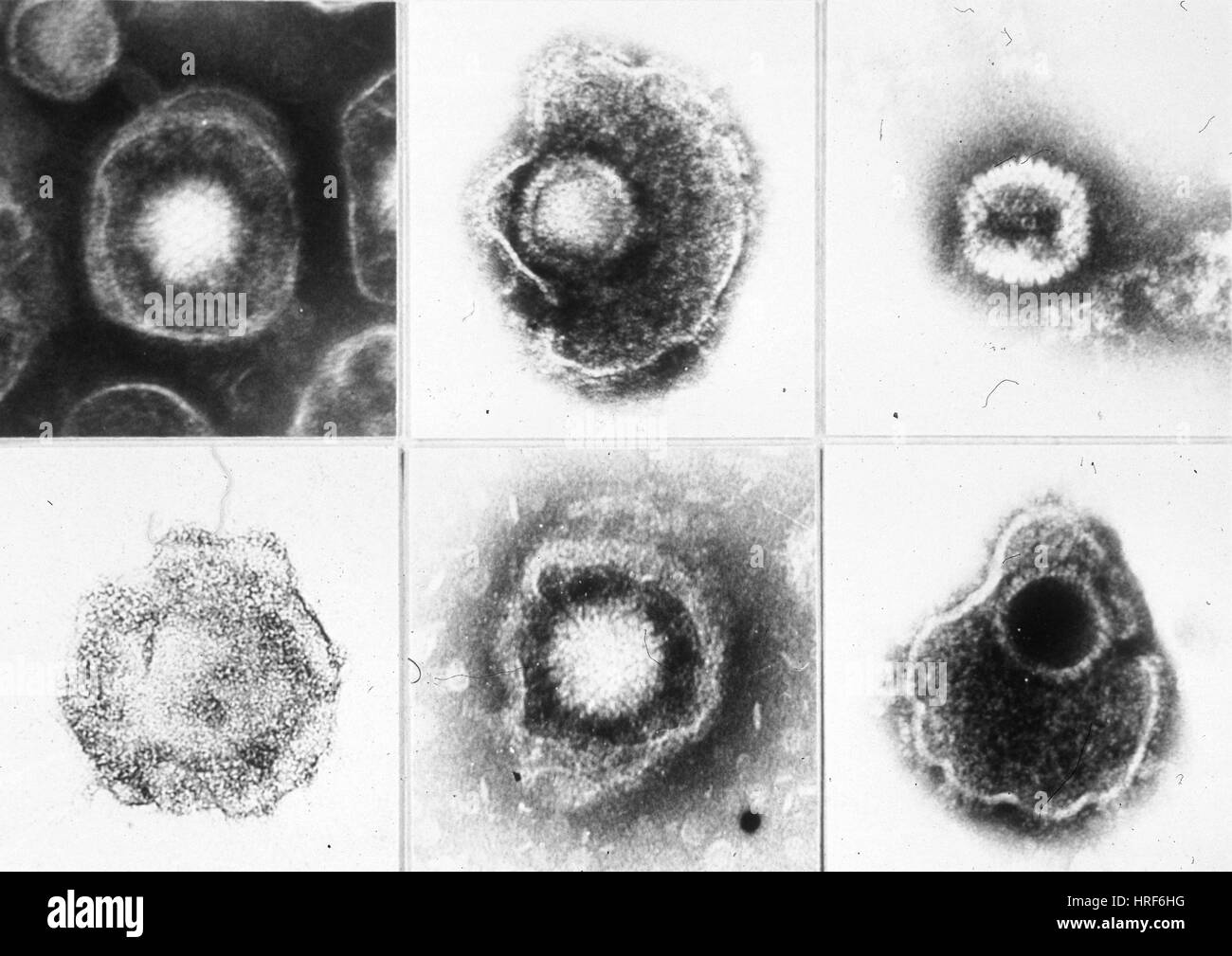 Various Forms of Herpes Simplex Virus (TEM Stock Photo - Alamy