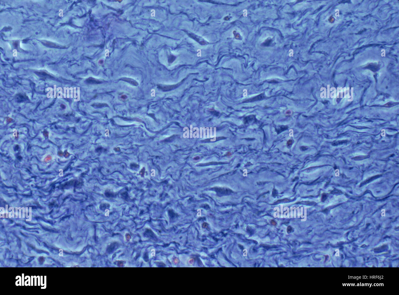 Mucous Connective Tissue