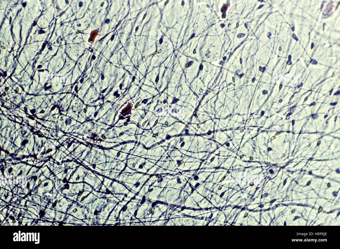 Loose connective tissues hi-res stock photography and images - Alamy