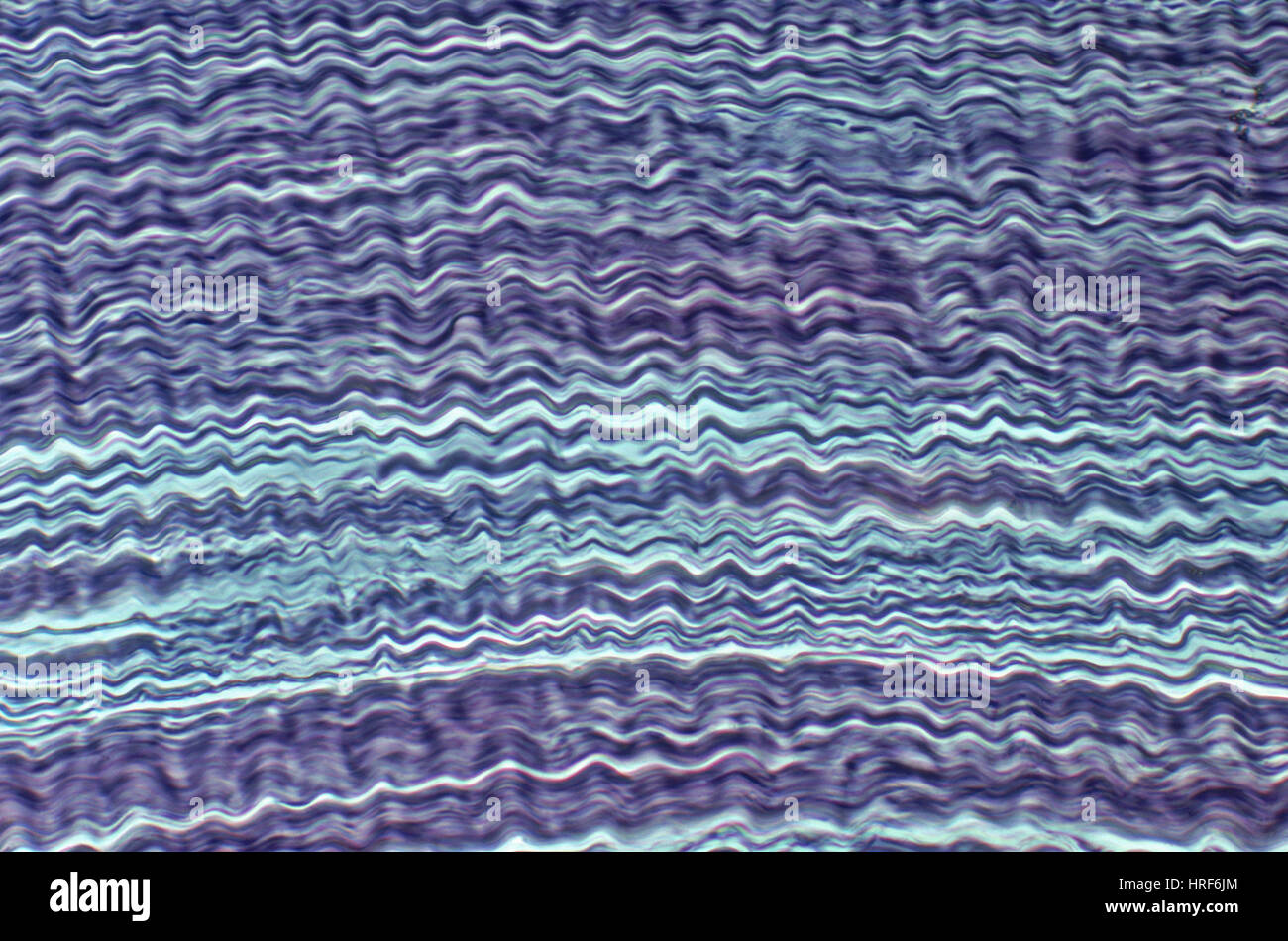 Tendon micrograph hi-res stock photography and images - Alamy