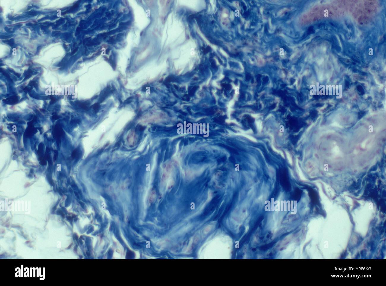 Connective tissue light micrograph hi-res stock photography and images ...
