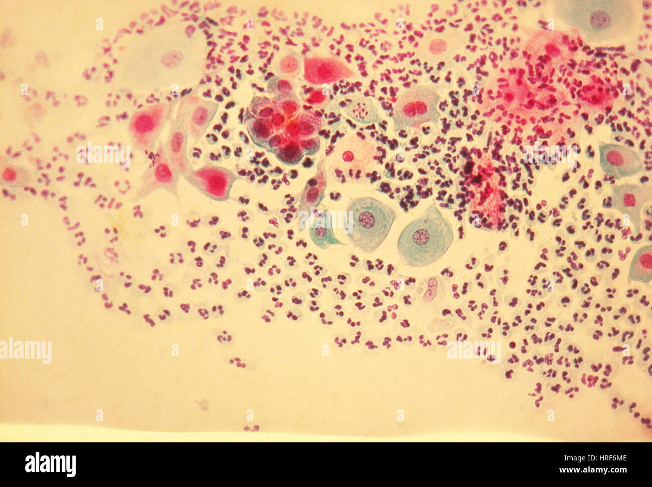 Pap test pap smear hi-res stock photography and images - Alamy