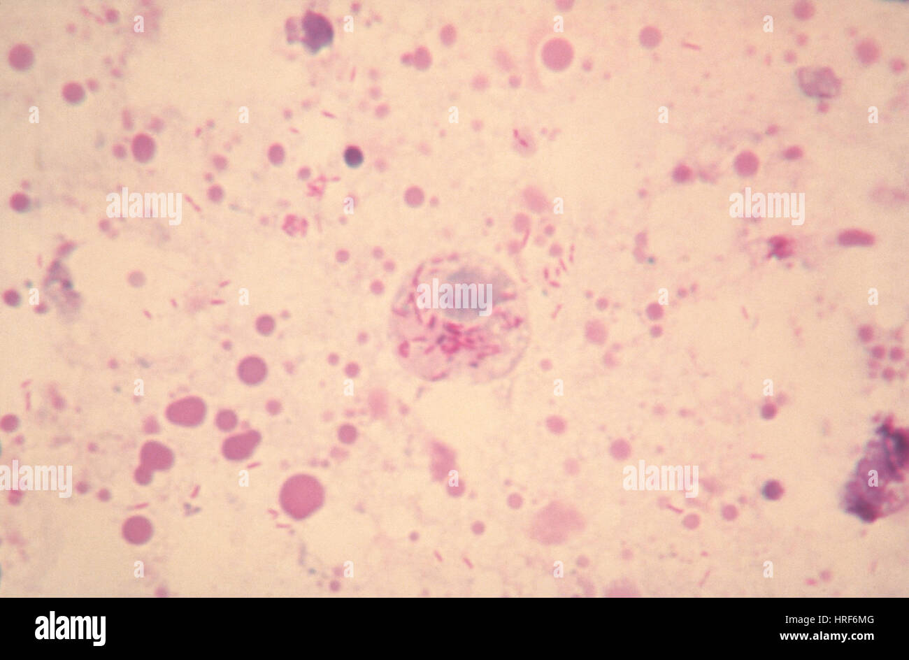 Rickettsia hi-res stock photography and images - Alamy