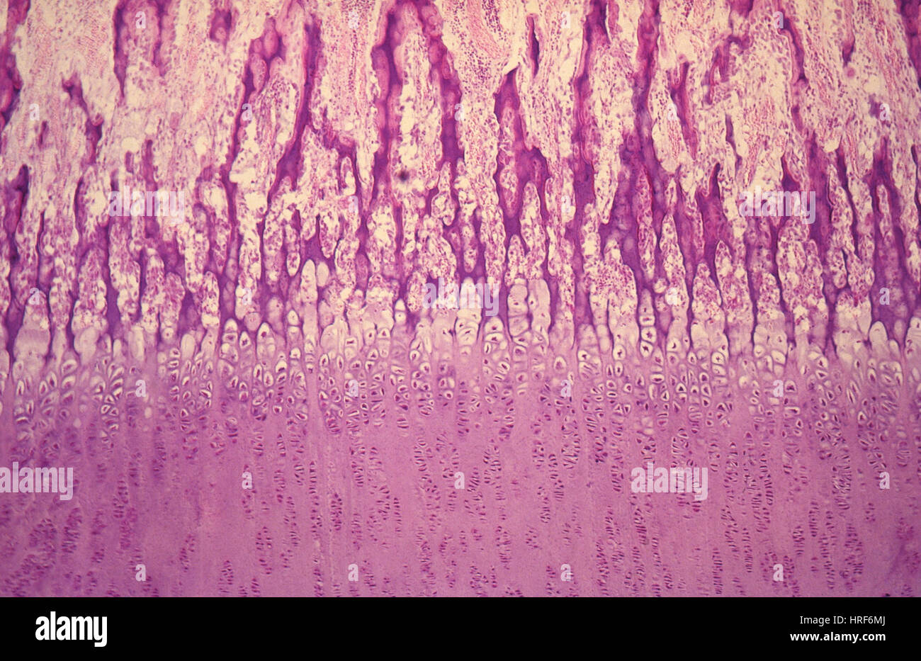 Histology of bone hi-res stock photography and images - Alamy