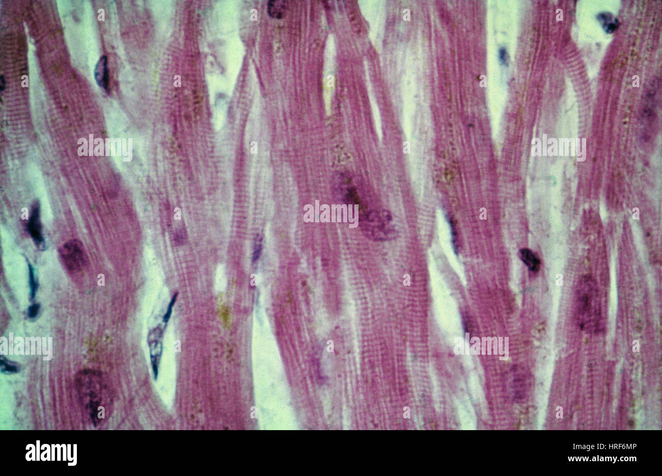 Cardiac Muscle 400x