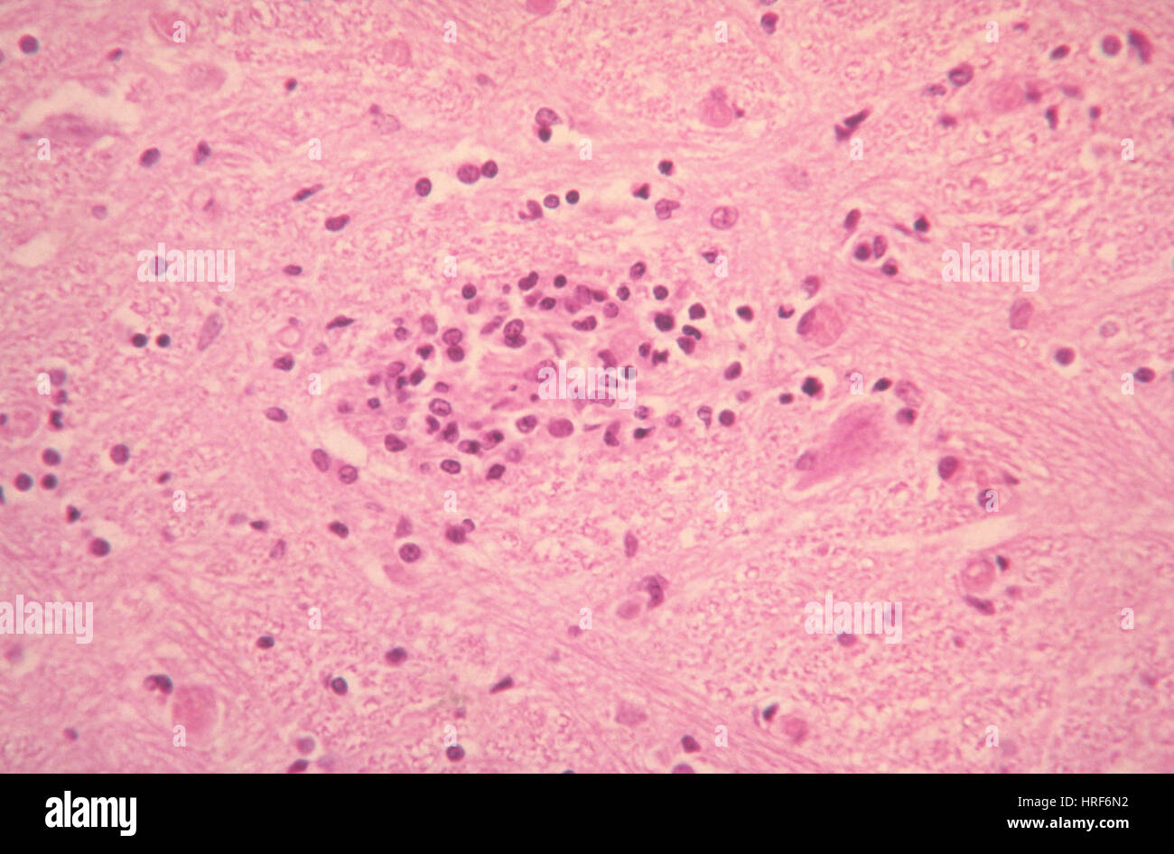 Rickettsia Rickettsii Microscope