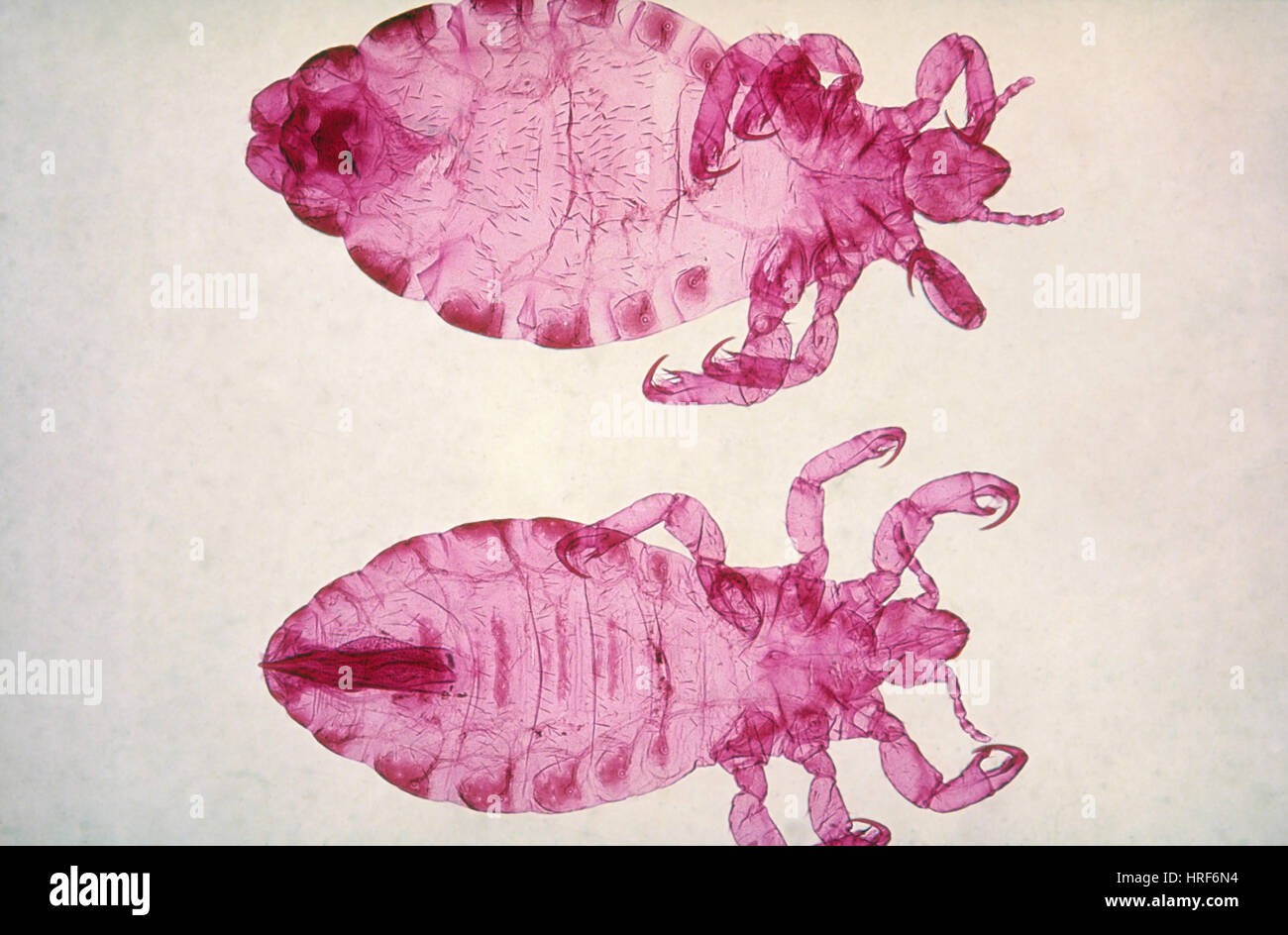 Body Lice Stock Photos & Body Lice Stock Images - Alamy
