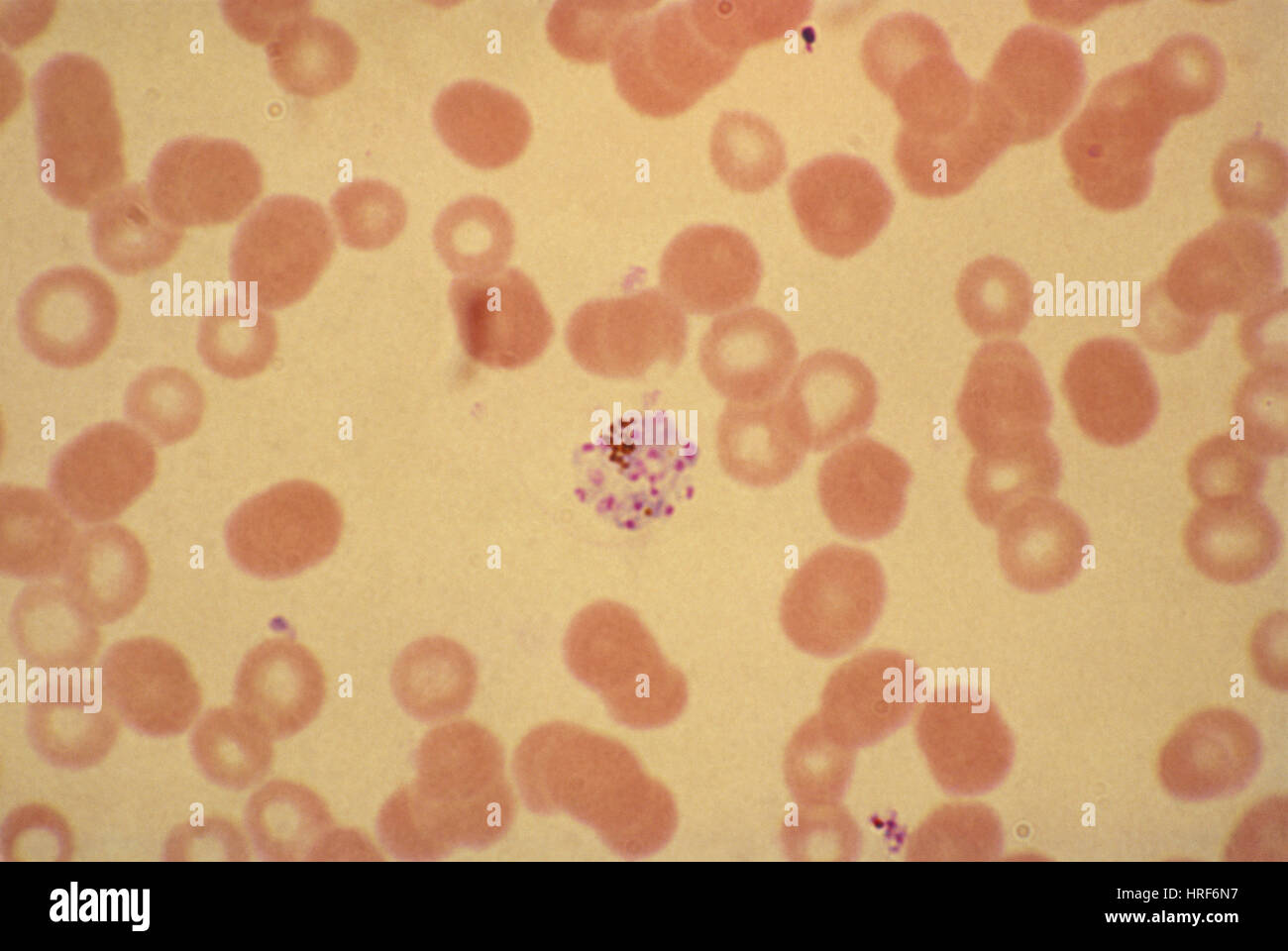 Plasmodium vivax trophozoite hi-res stock photography and images - Alamy