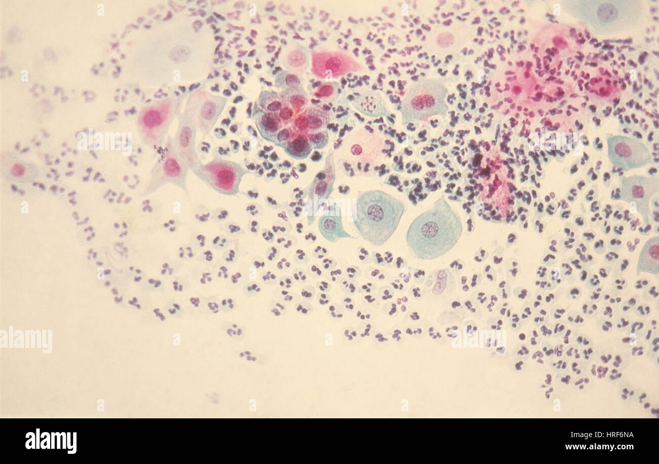 Stellate cells hi-res stock photography and images - Alamy